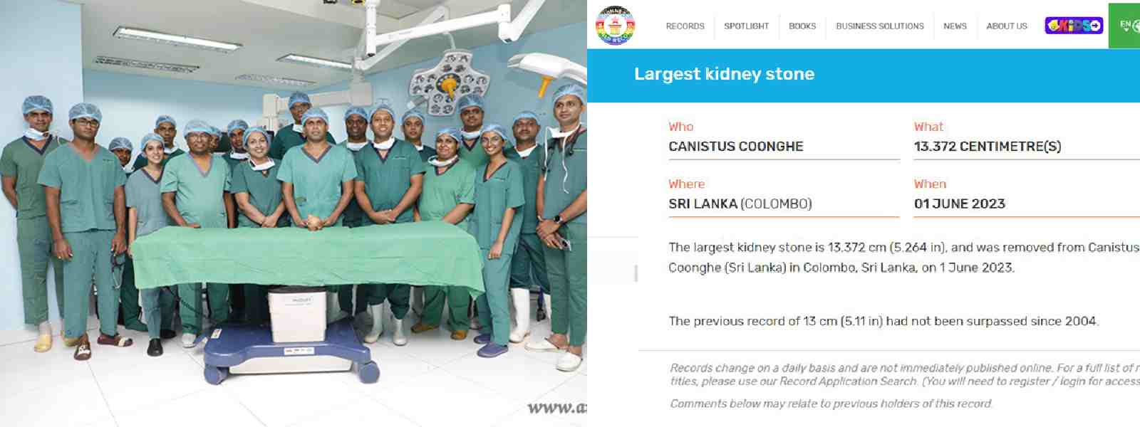 Army Doctors Enter Guinness World Records Removing the World’s Largest ...
